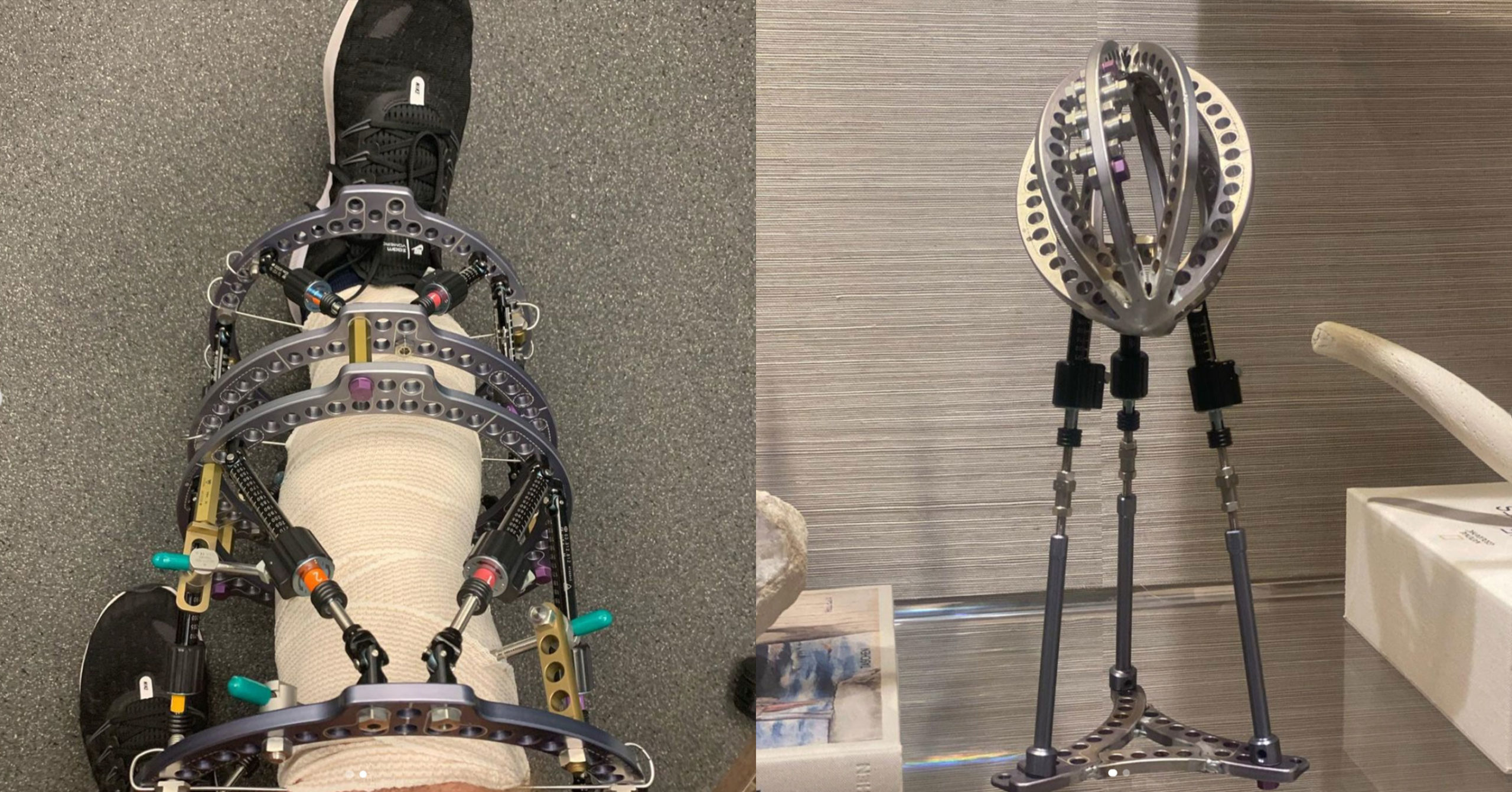 Alex Smith's Wife Transformed Her Husband's Leg Brace Into Super Bowl ...