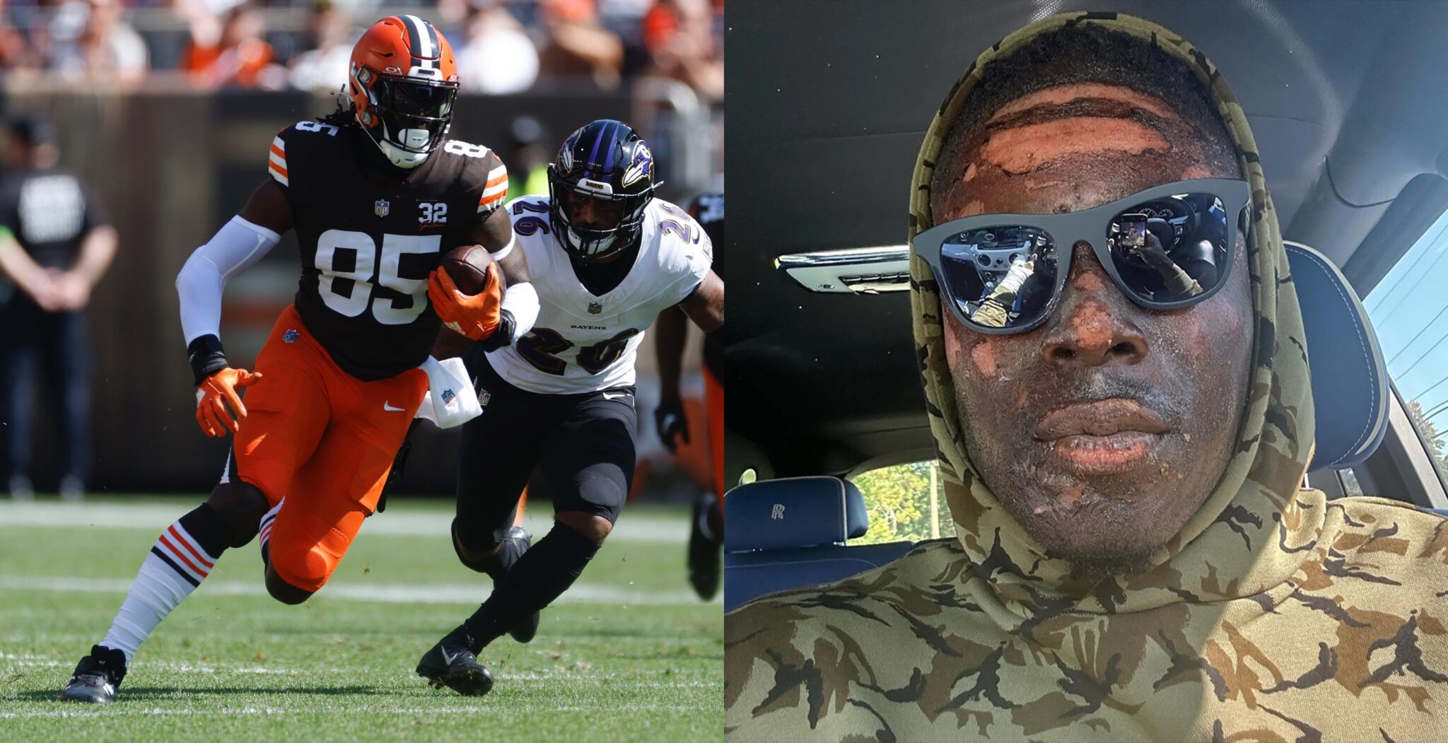 Browns TE David Njoku Reveals Shocking Facial Burns He Suffered In Fire ...
