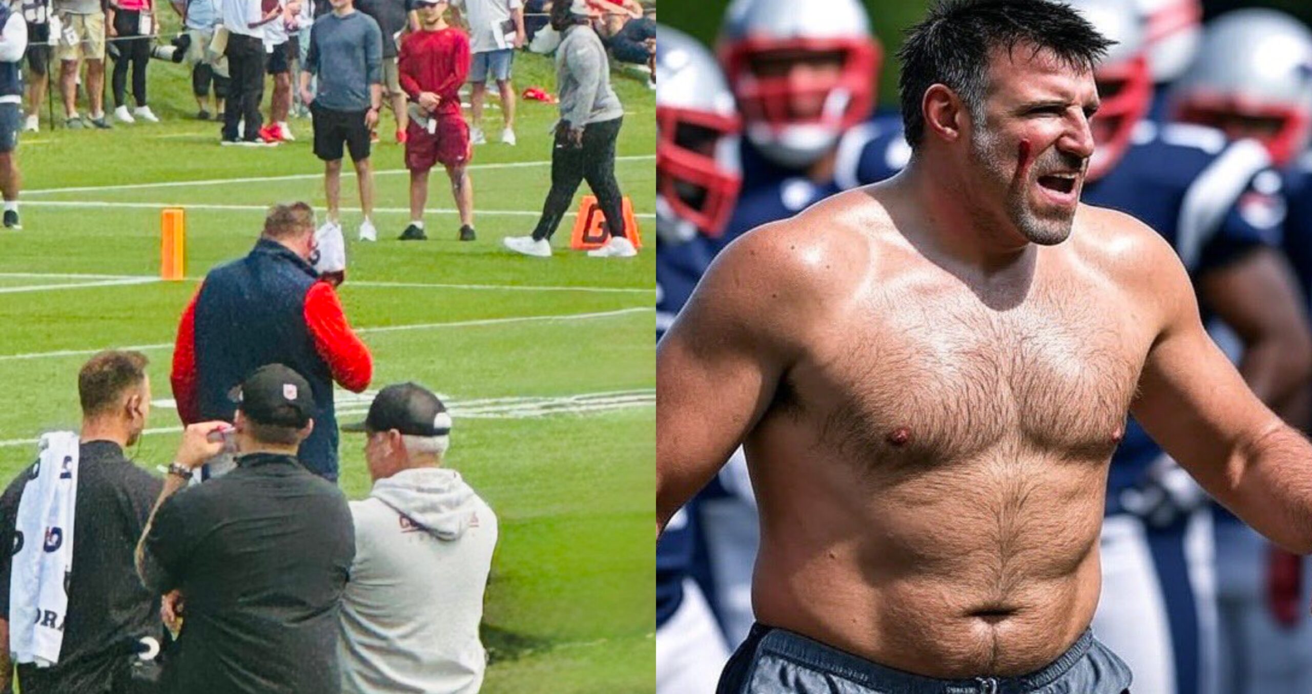Patriots Head Coach Mike Vrabel Bloodied After Jumping Into Scrum ...
