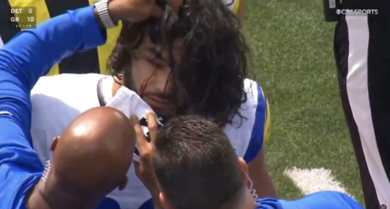 Puka Nacua Leaves Game vs Texans After Bloody Injury, Being Evaluated For Concussion - Daily Snark